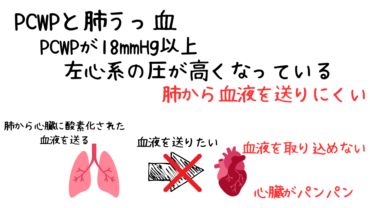 フォレスター分類で心不全を攻略！臨床工学技士必見のポイントまとめ | みんなのMEセンター