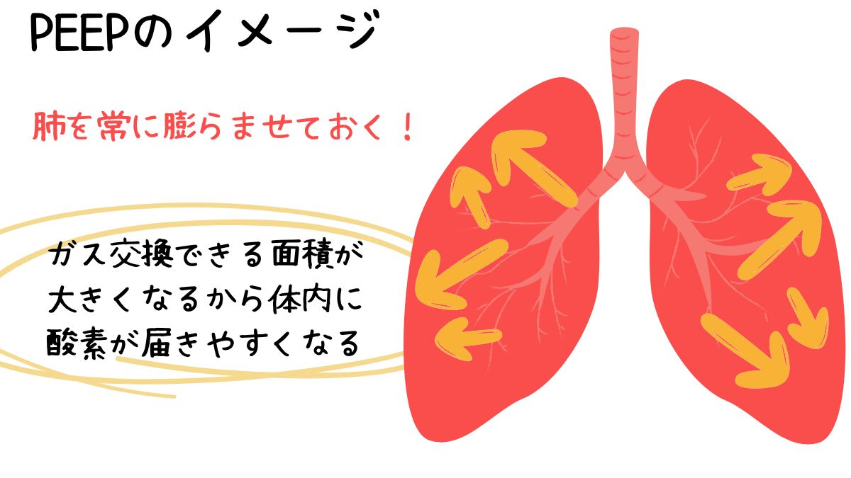 新人臨床工学技士が迷うPEEP設定、上げ下げの判断軸 | みんなのMEセンター