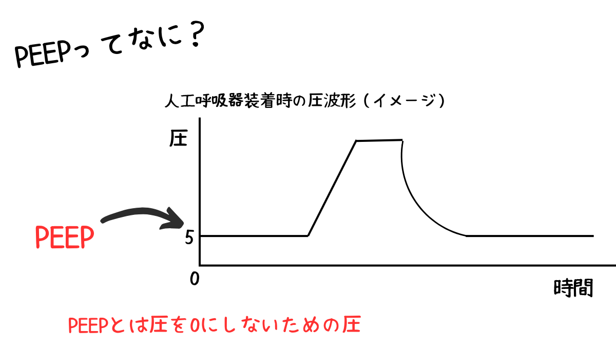 新人臨床工学技士が迷うPEEP設定、上げ下げの判断軸 | みんなのMEセンター