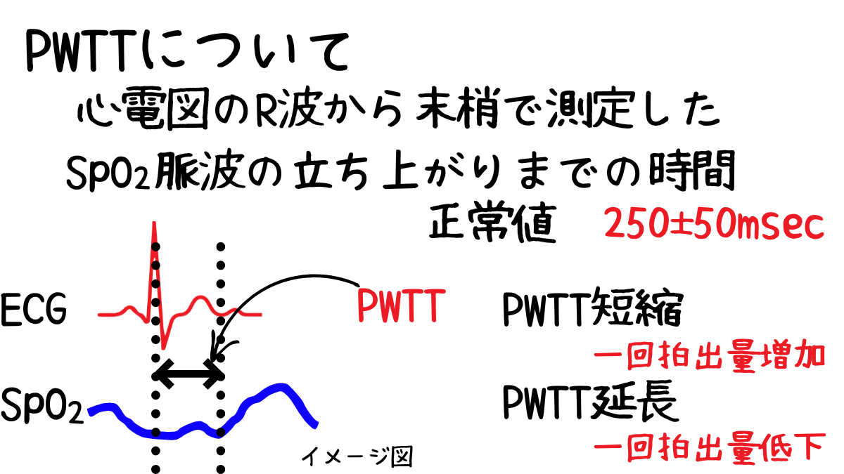 非侵襲で心拍出量を測定できるesCCOについて | みんなのMEセンター