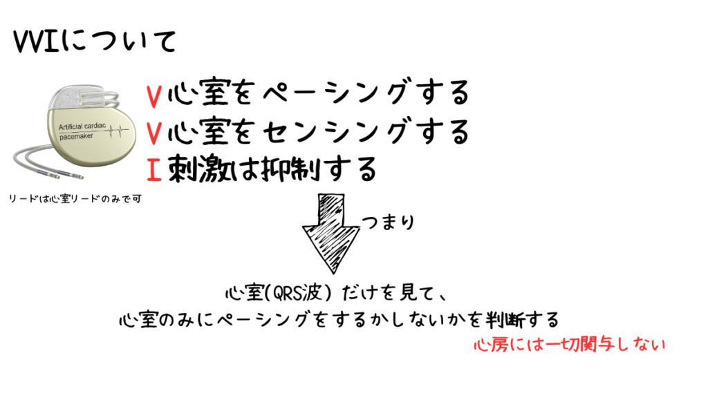 ペースメーカーの基本設定 VVIについて | みんなのMEセンター