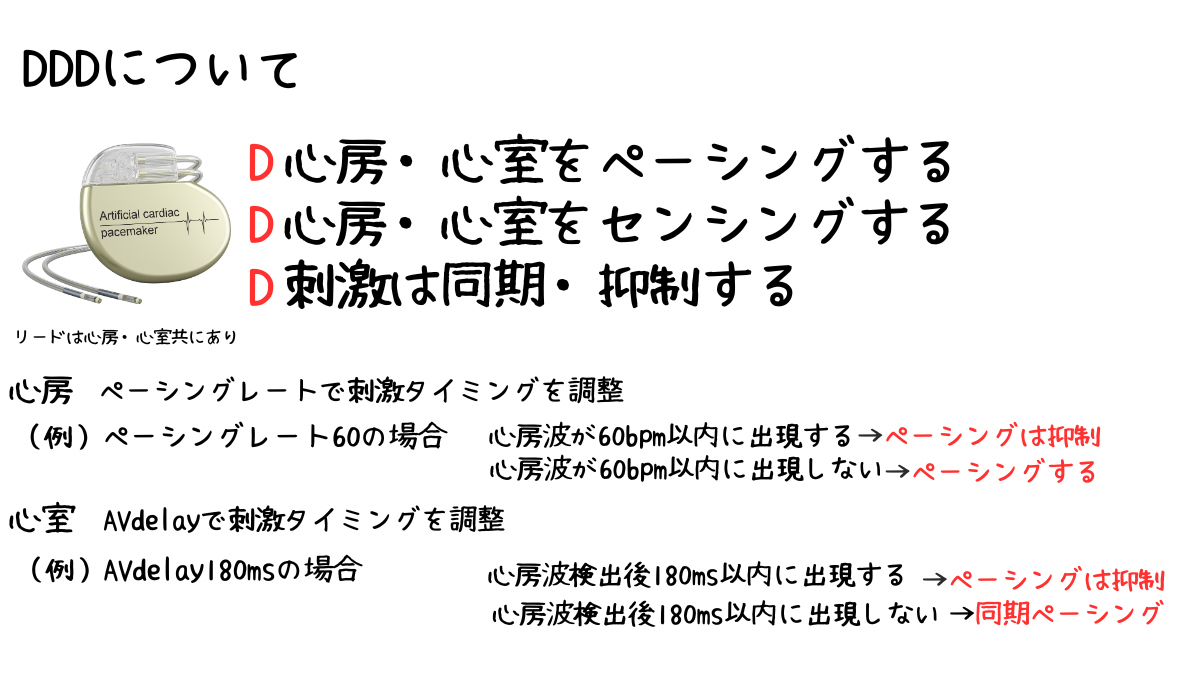 ペースメーカーの基本設定 DDDについて | みんなのMEセンター