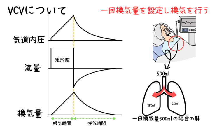 人工呼吸器が空気を送る法則！VCVとPCVについて | みんなのMEセンター