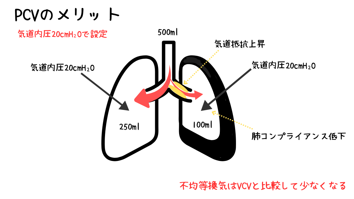 人工呼吸器が空気を送る法則！VCVとPCVについて | みんなのMEセンター