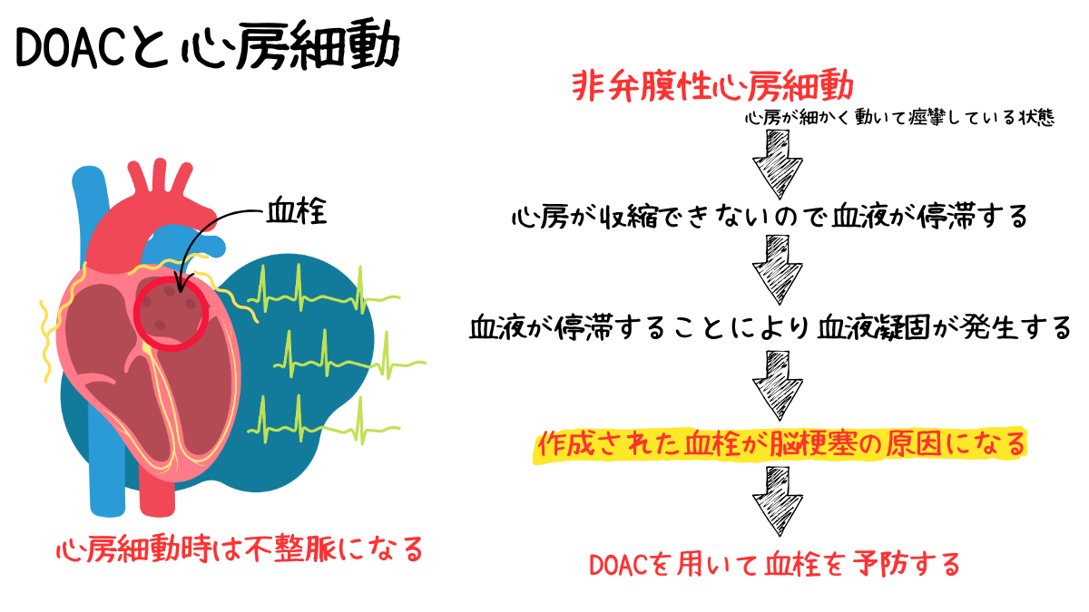 心房細動とは切り離せない DOACについて | みんなのMEセンター