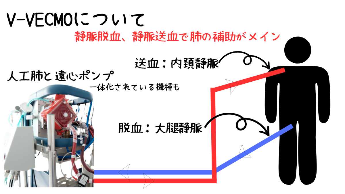 V-VECMOをゼロから学ぶ：初心者でもわかる仕組みと実践ポイント | みんなのMEセンター
