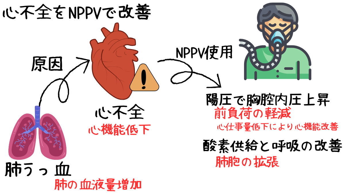 臨床工学技士のためのNPPV入門：設定のコツと心不全治療のポイント | みんなのMEセンター