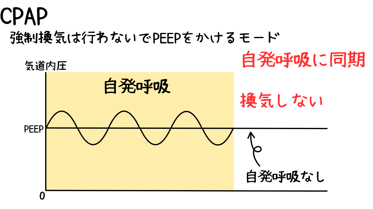 臨床工学技士のためのNPPV入門：設定のコツと心不全治療のポイント | みんなのMEセンター