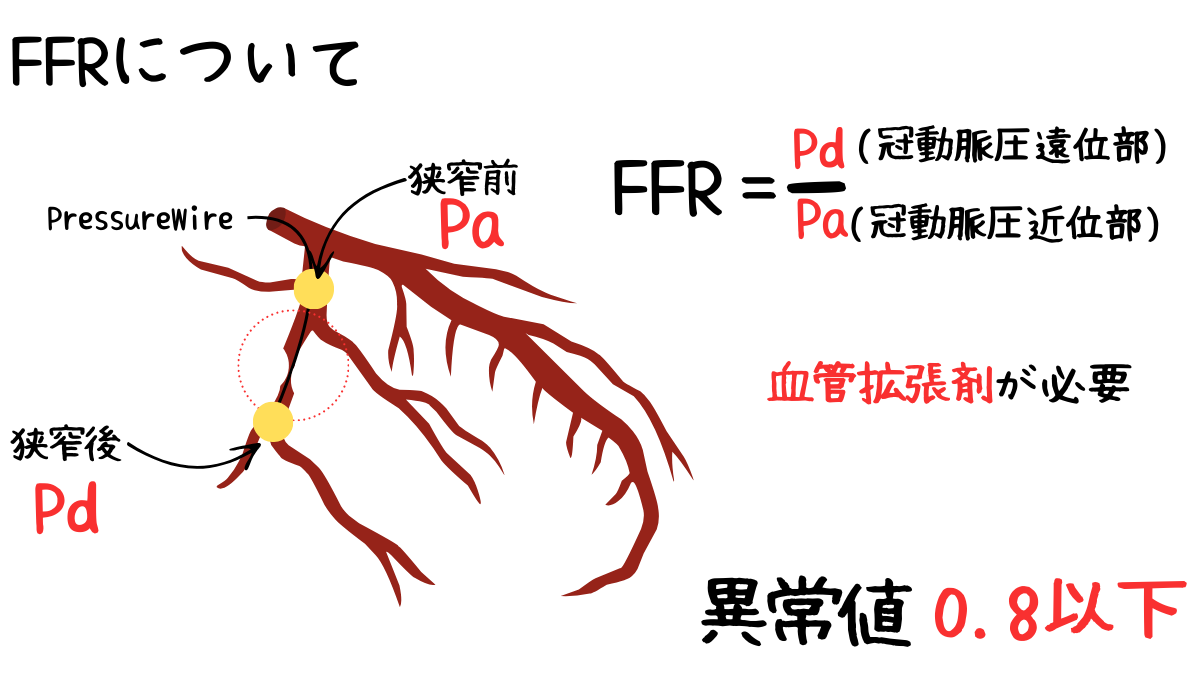 心血管評価の鍵！FFRとRFRをわかりやすく比較 | みんなのMEセンター